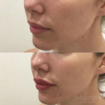 Best Laser Skin Clinic Sydney | Skin Care Clinic | Evolution Laser Clinic