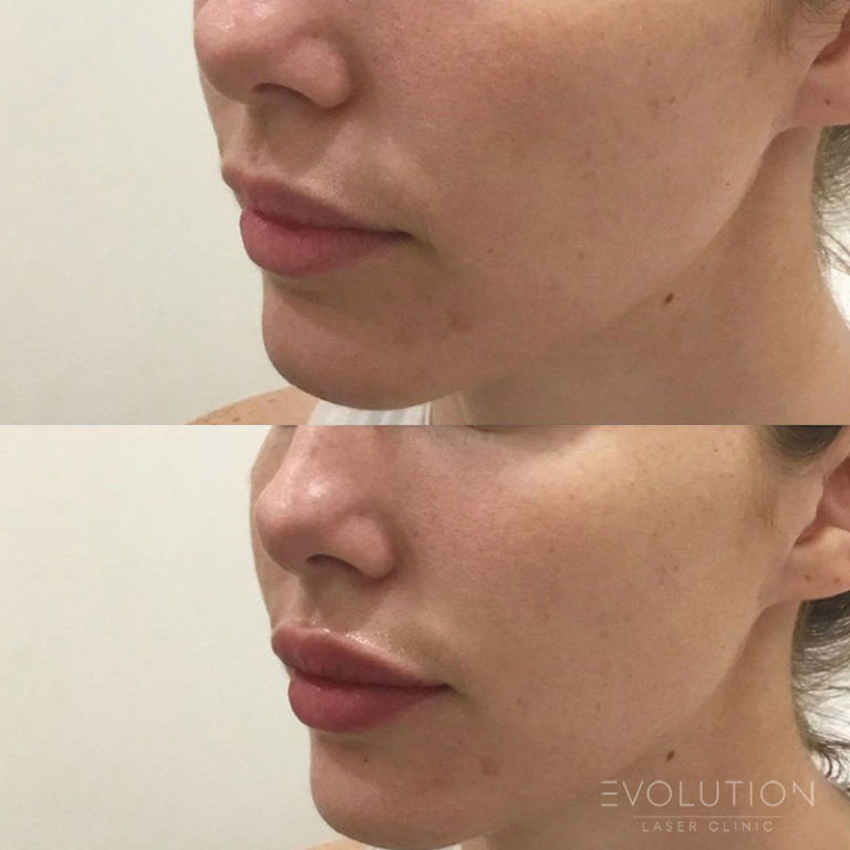 Best Laser Skin Clinic Sydney | Skin Care Clinic | Evolution Laser Clinic