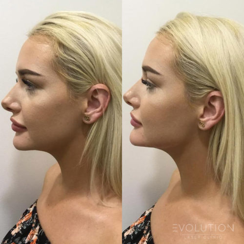 Best Laser Skin Clinic Sydney | Skin Care Clinic | Evolution Laser Clinic