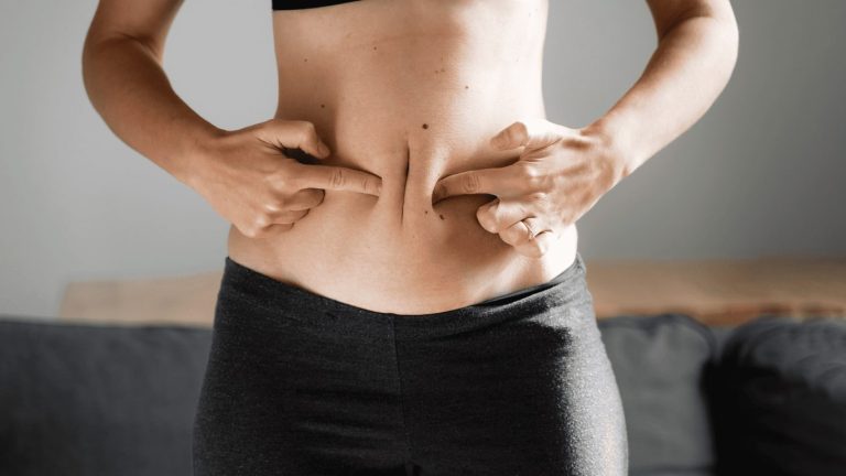 Abdominal Separation: What Is Diastasis Recti and How EMS Can Help